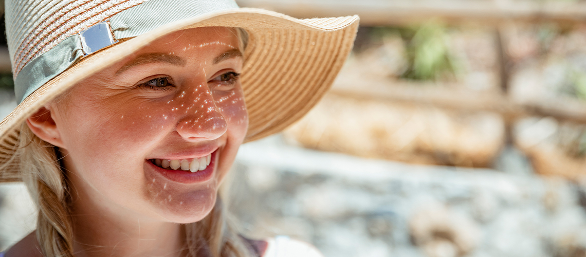 Ruusufinni eli rosacea – näin tunnistat ja hoidat | Itsehoitoapteekki